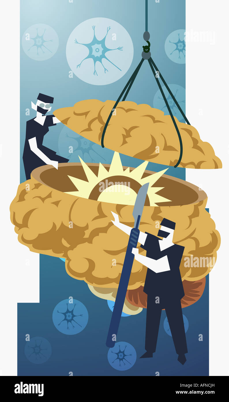 Female surgeon opening a human brain Stock Photo - Alamy