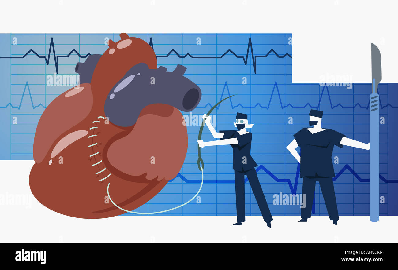 Woman heart surgery stitches hi-res stock photography and images - Alamy