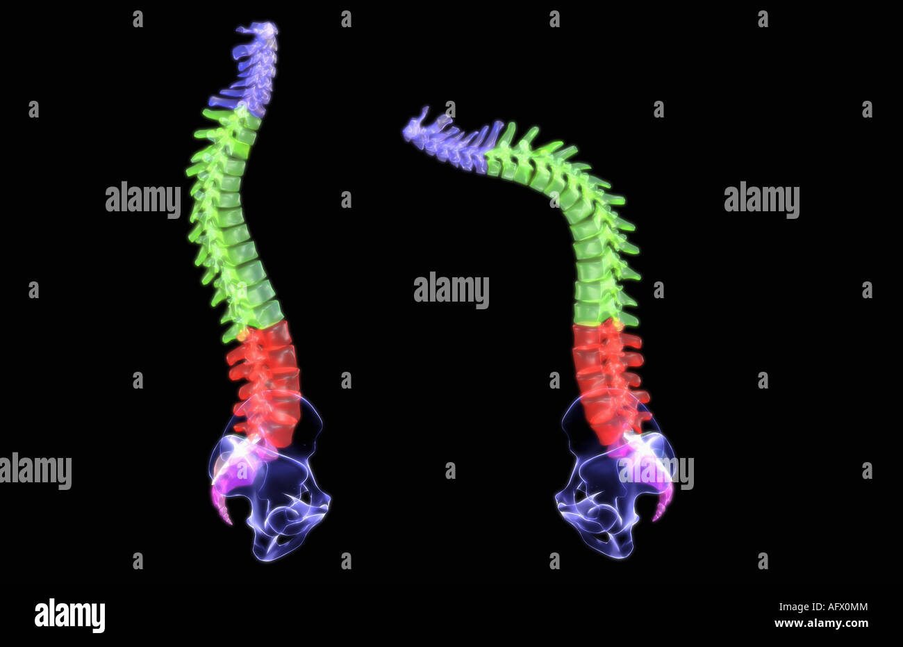 Spondyloarthritis hi-res stock photography and images - Alamy