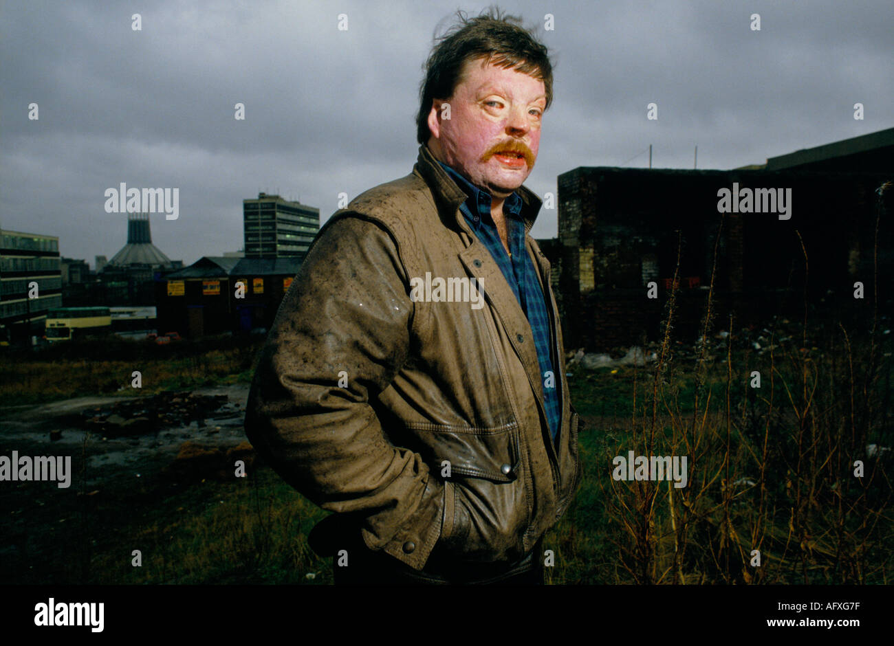 Simon Weston portrait Falklands War victim hero. 1988 He set up ...