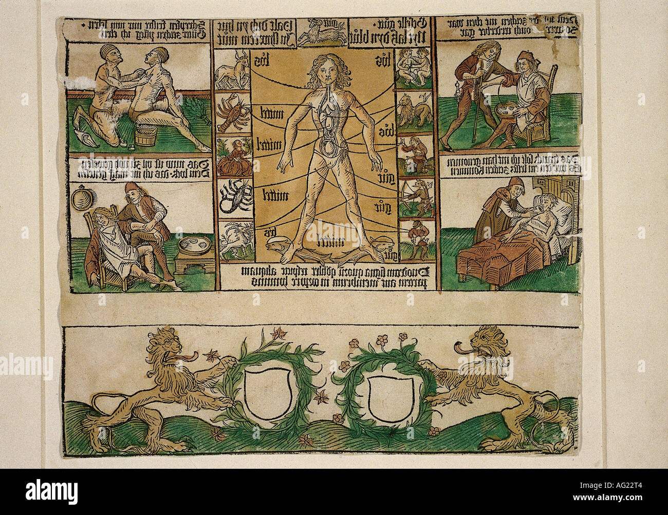 Venesection hi-res stock photography and images - Alamy