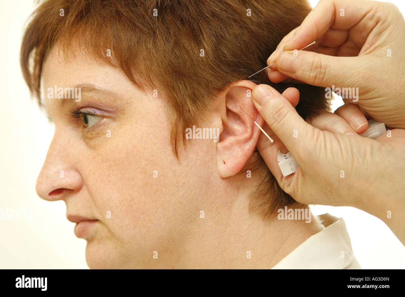 Accupuncture points hi-res stock photography and images - Alamy
