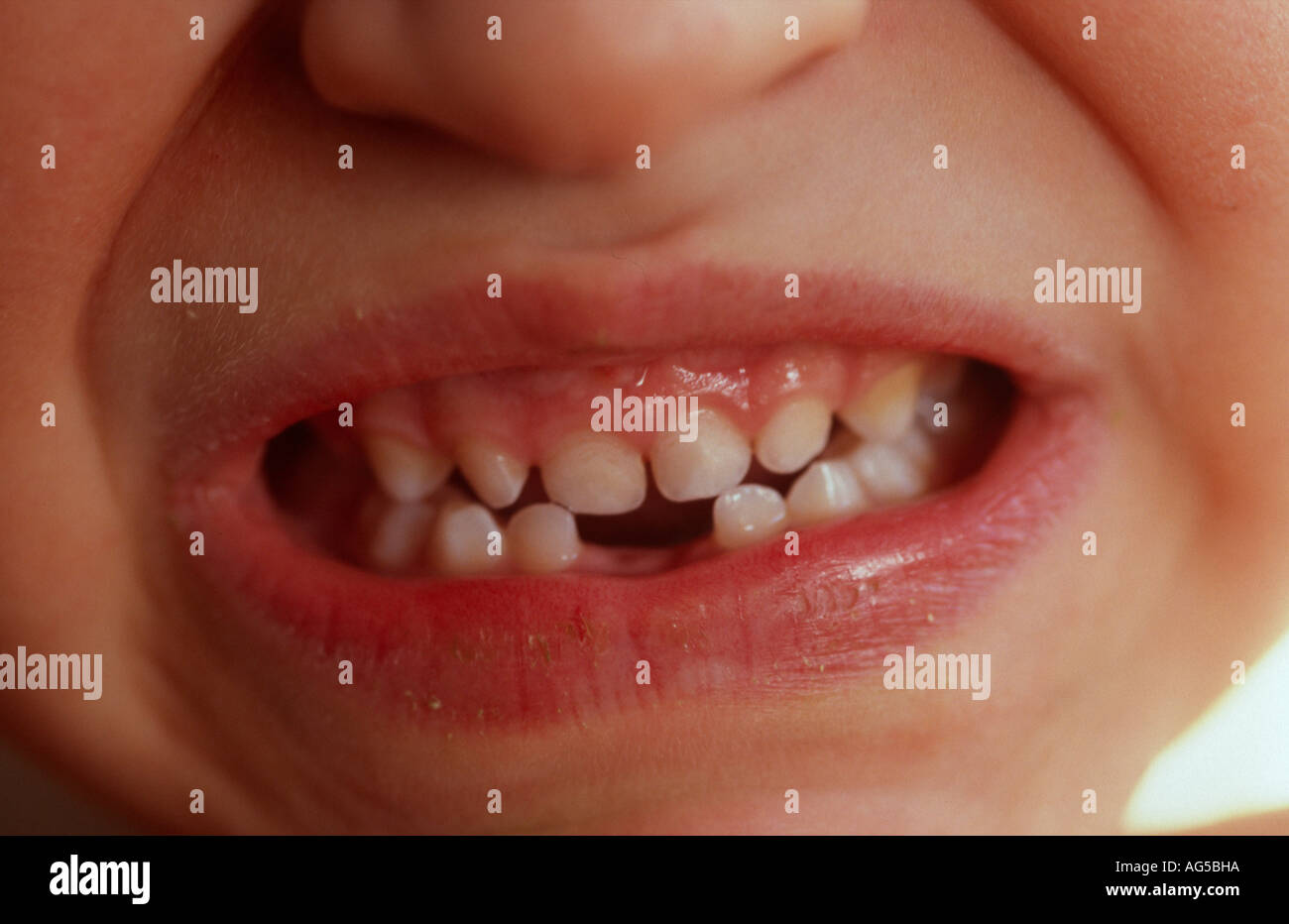 Boy is showing his tooth space Stock Photo - Alamy