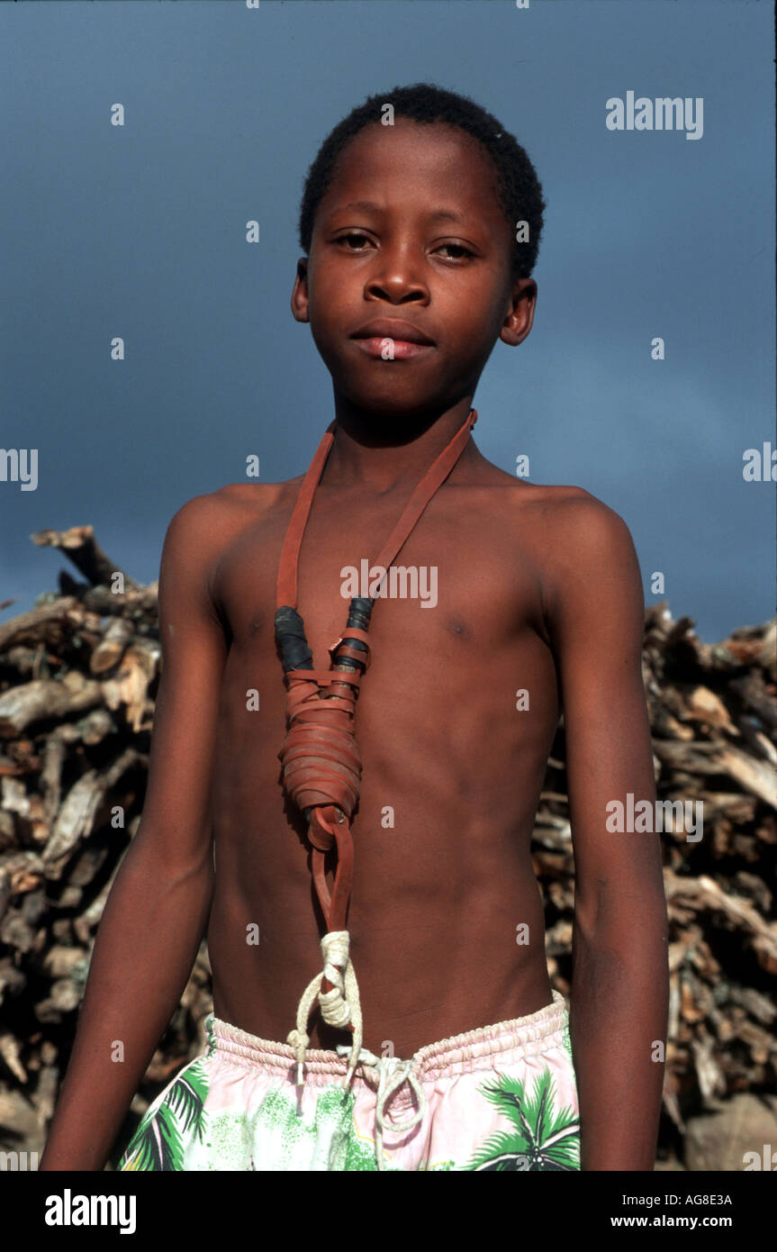 ZIMBABWE BOY WITH A SLING BULAWAYO Photo Julio Etchart Stock Photo - Alamy