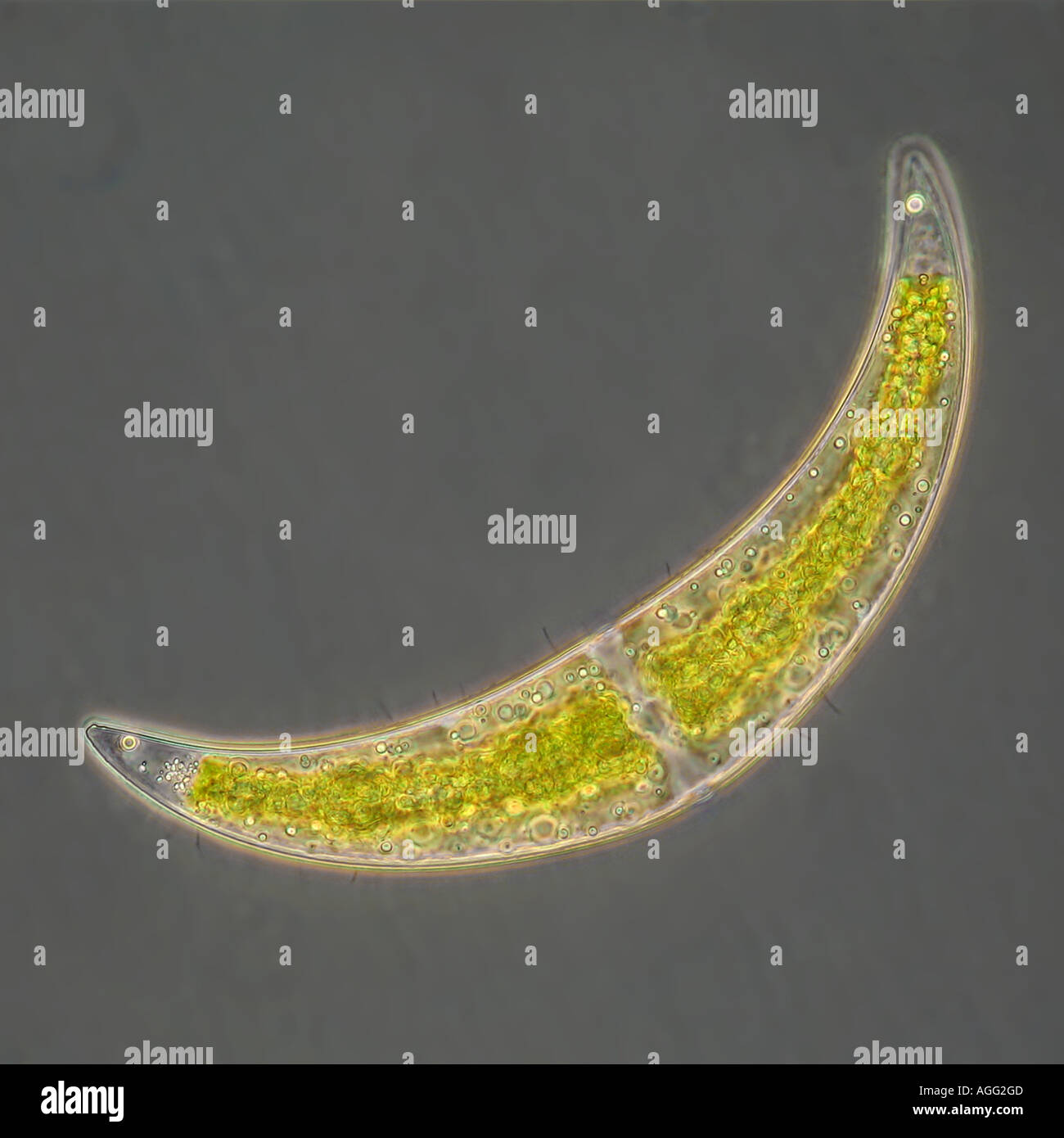 Closterium leibleinii (Closterium leibleinii), with phase-contrast MRI ...