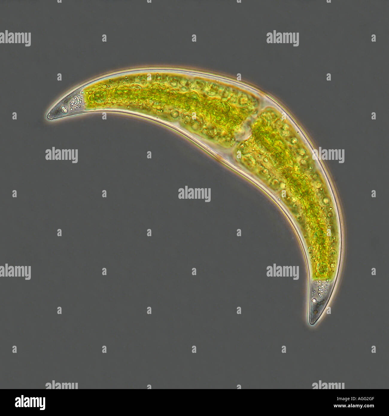 Closterium leibleinii (Closterium leibleinii), with phase-contrast MRI ...