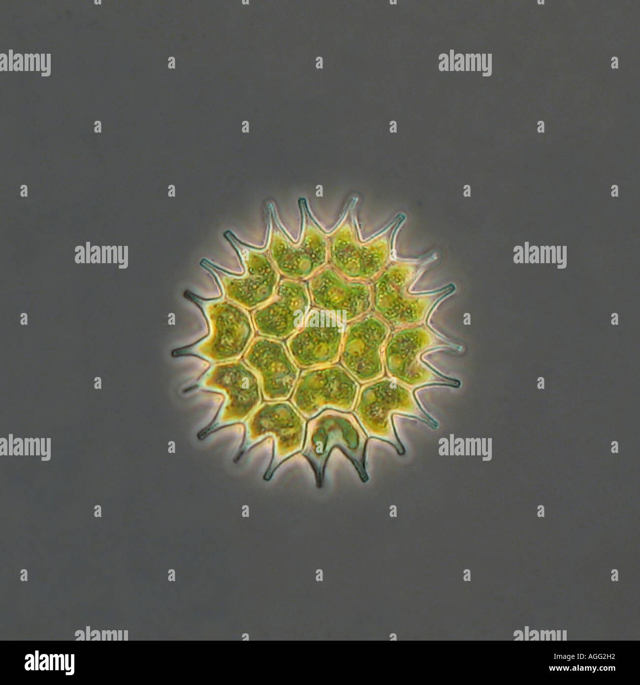 Pediastrum boryanum (Pediastrum boryanum), with phase-contrast MRI ...