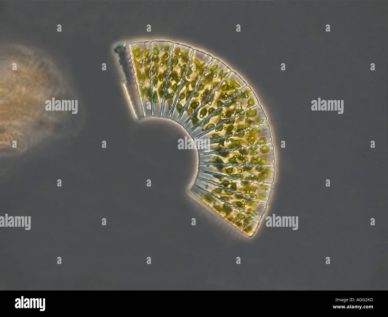 Meridion circulare (Meridion circulare), with phase-contrast MRI Stock ...