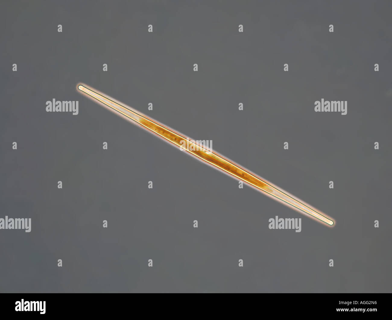 Synedra ulna (Synedra ulna), with phase-contrast MRI Stock Photo - Alamy