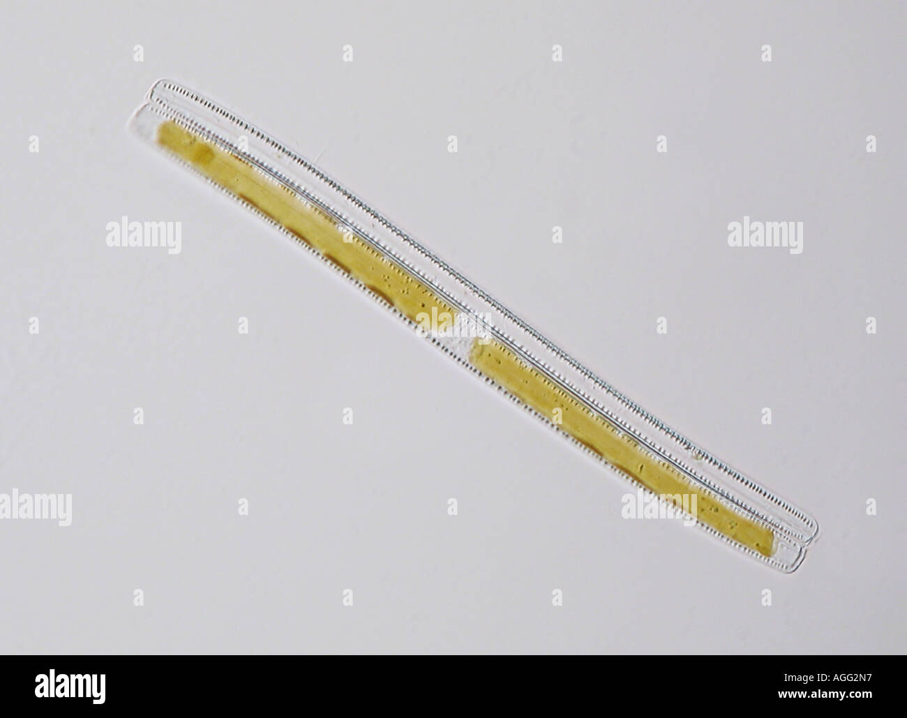 Nitzschia sigmoidea (Nitzschia sigmoidea), in shining through light ...