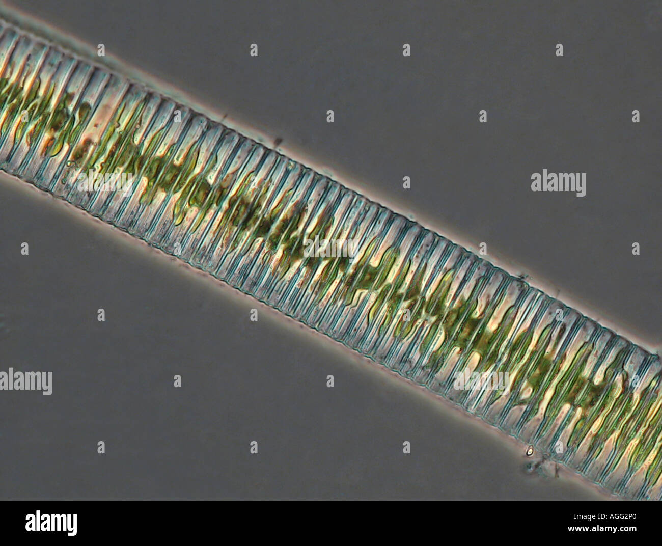 Fragilaria capucina (Fragilaria capucina), with phase-contrast MRI ...