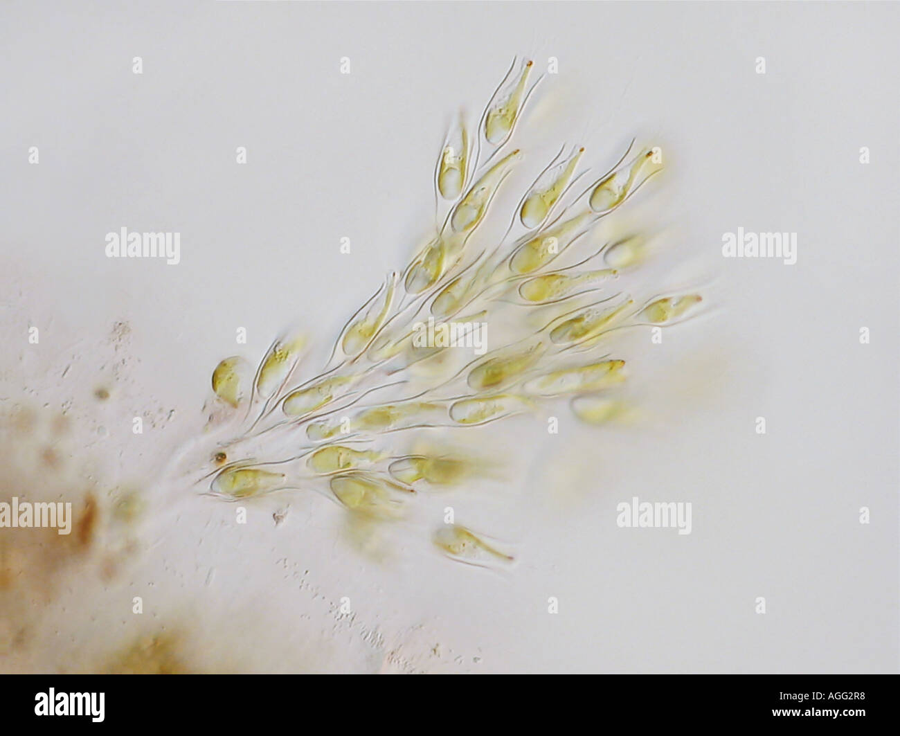 Dinobryon Chrysophyta