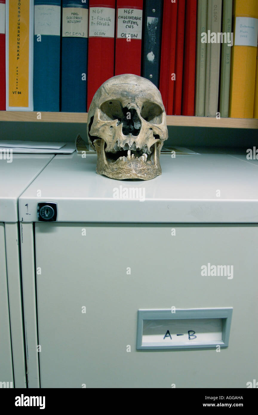 human scull of a murder victim in a forensic laboratory/department ...