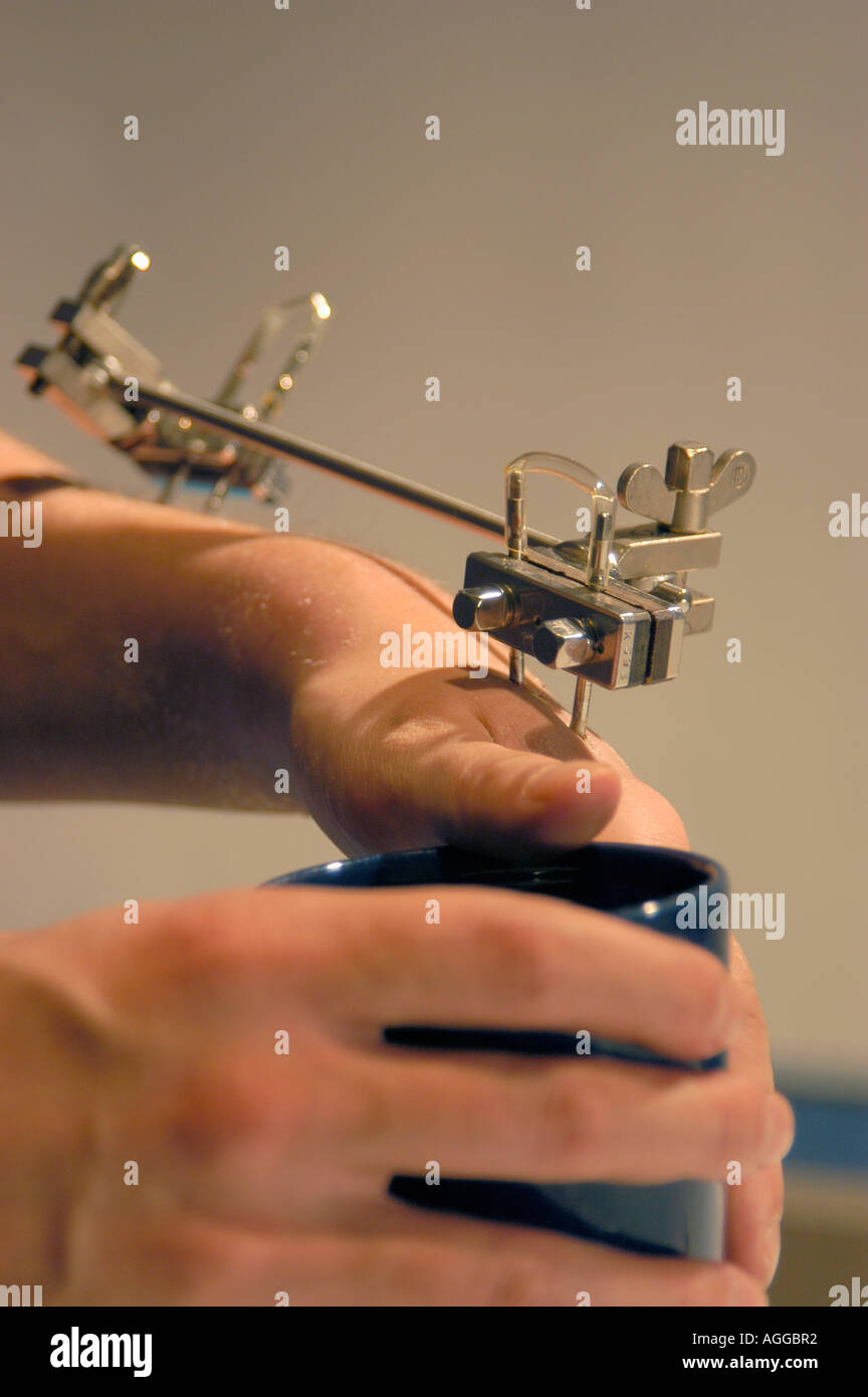 Healing broken ankle hi-res stock photography and images - Alamy