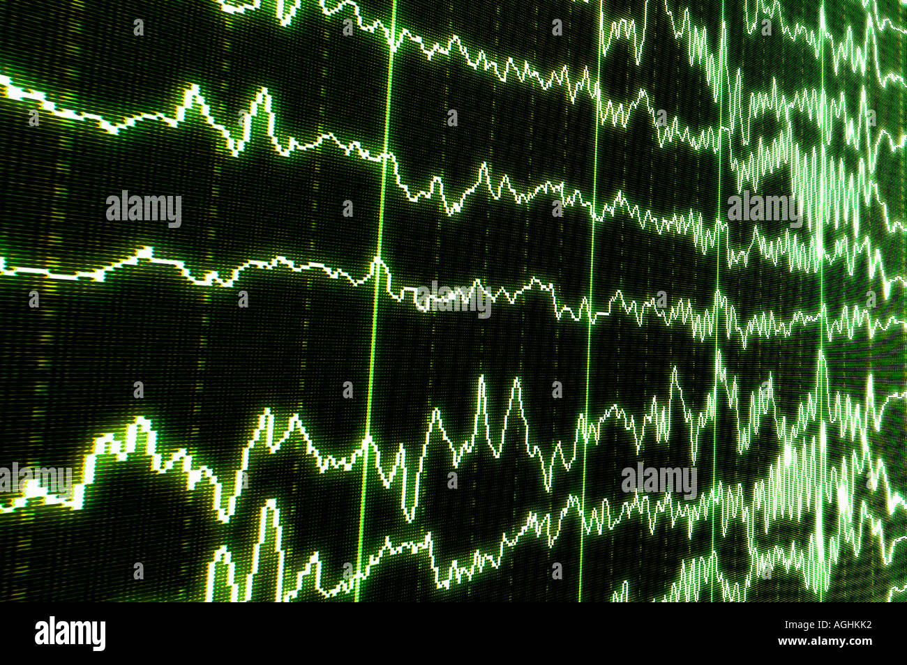 brain waves (alfa, beta, gamma) showing REM-sleep (dreaming) passing on ...