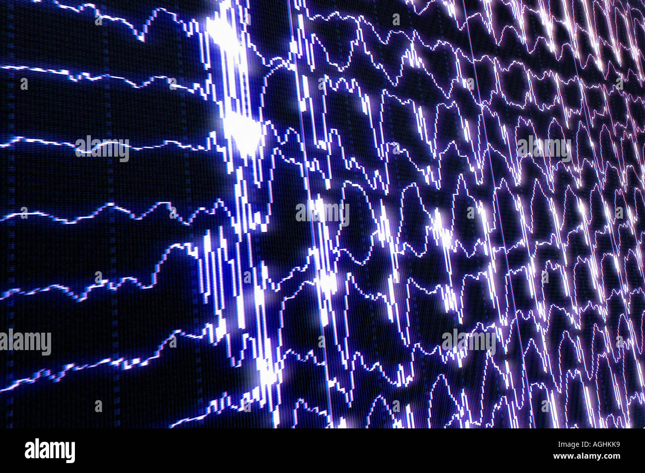 brain waves (alfa, beta, gamma) showing REM-sleep (dreaming) passing on ...