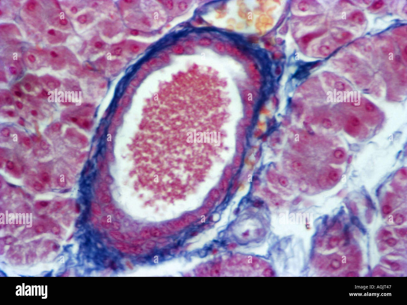 Pancreas cells hi-res stock photography and images - Alamy
