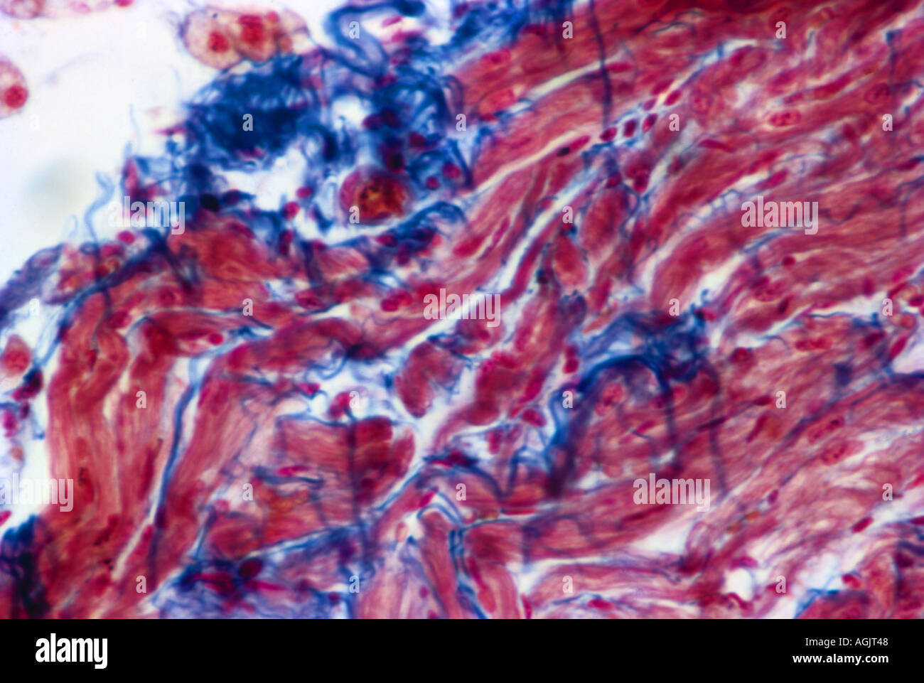 400x magnification hi-res stock photography and images - Alamy