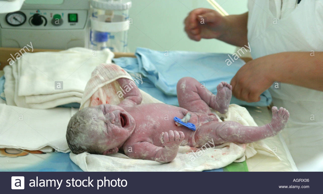 Neonates Stock Photos & Neonates Stock Images - Alamy
