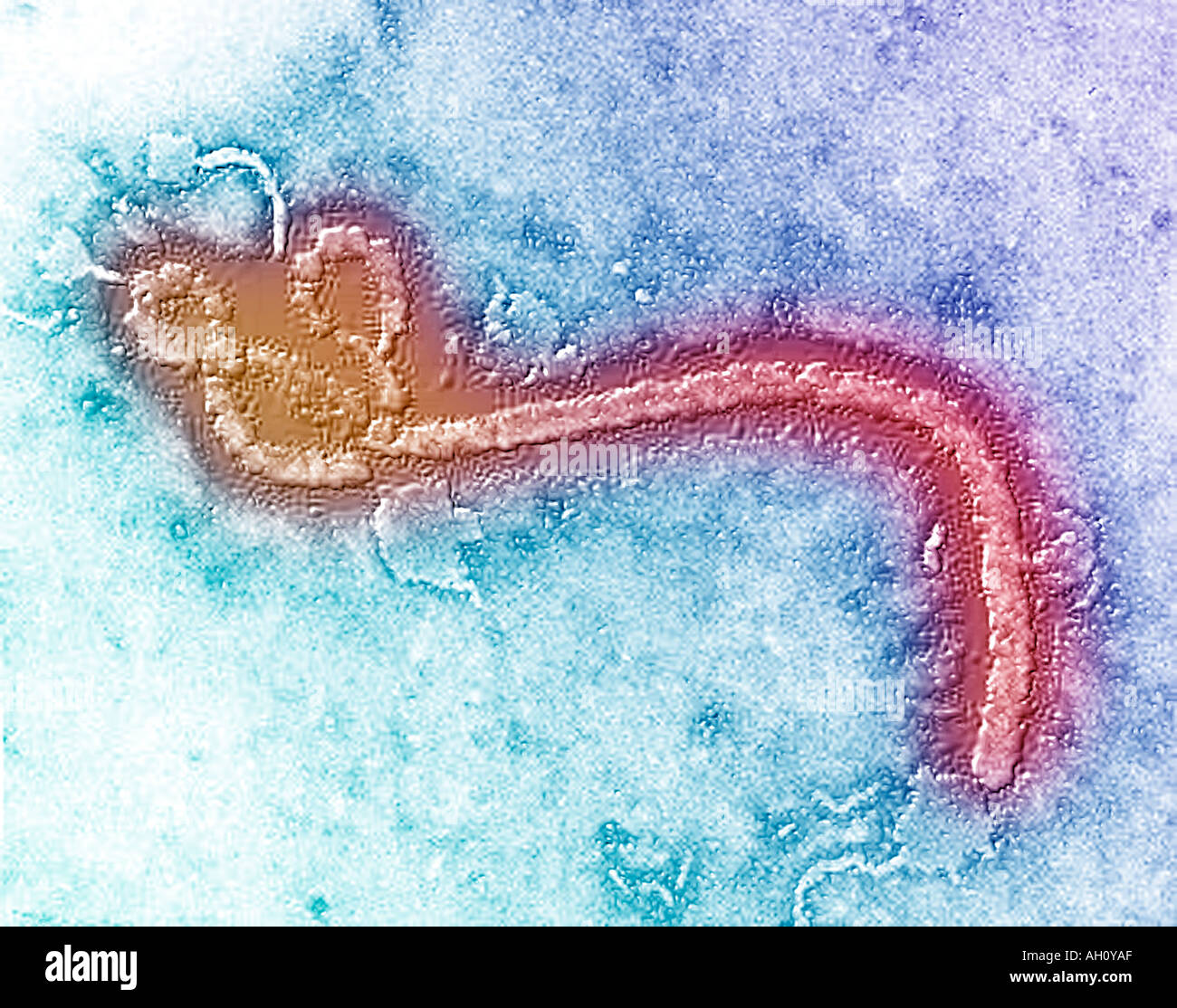 Ebola virus transmission electron micrograph image colorized Original ...