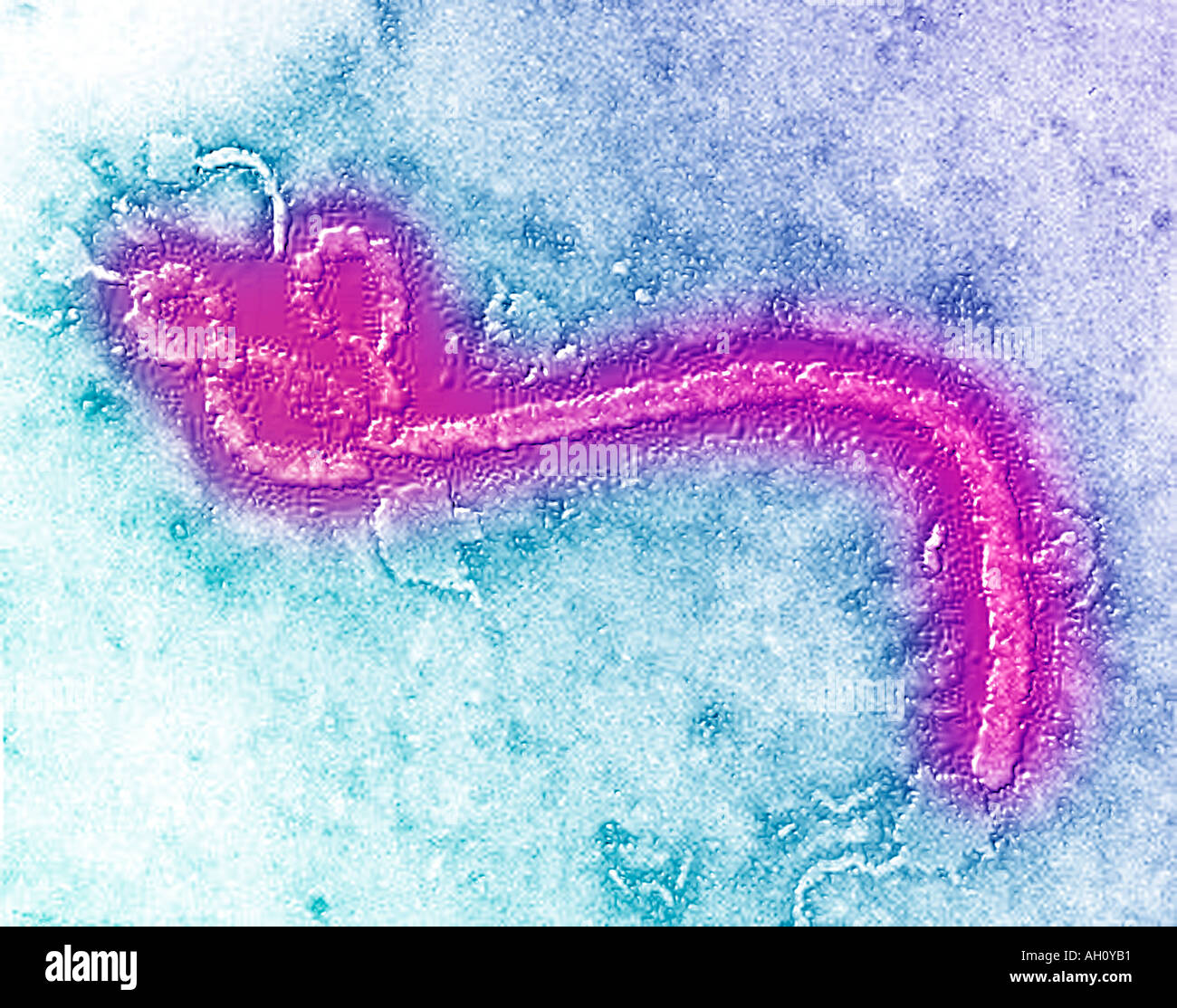 Ebola virus transmission electron micrograph image colorized Original ...