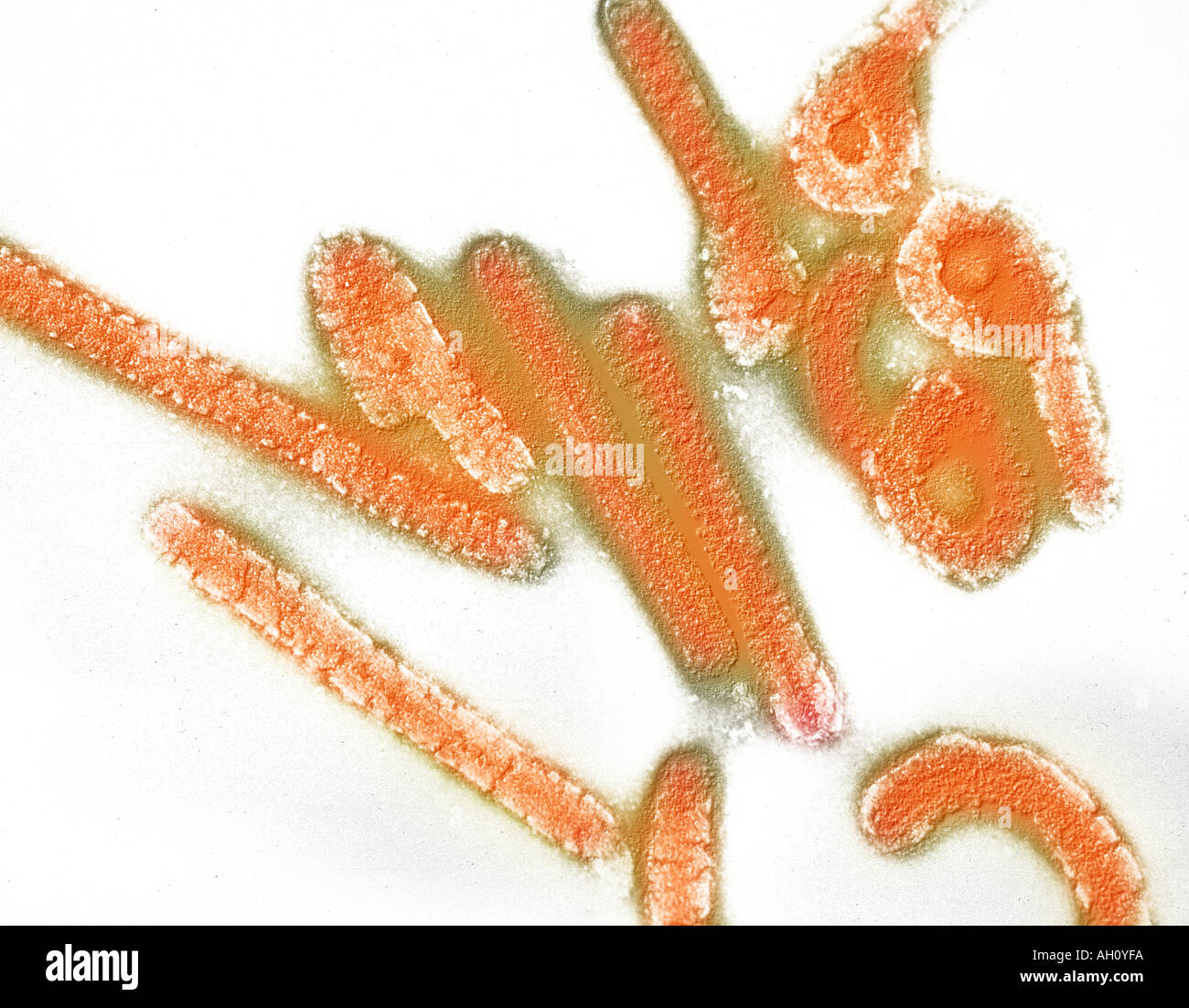 Marburg virus transmission electron microscope image colorized source ...