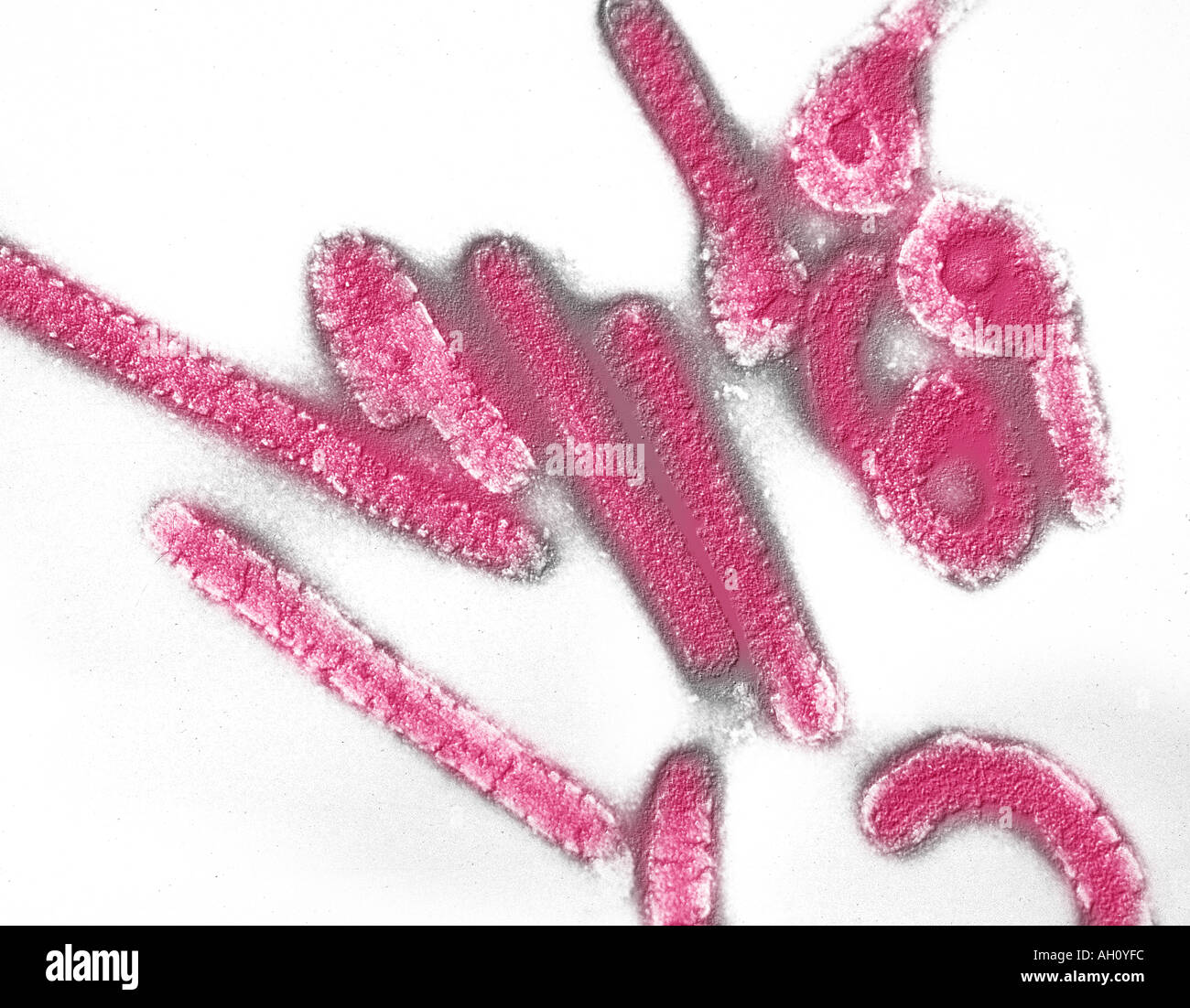 Marburg virus transmission electron microscope image colorized source ...