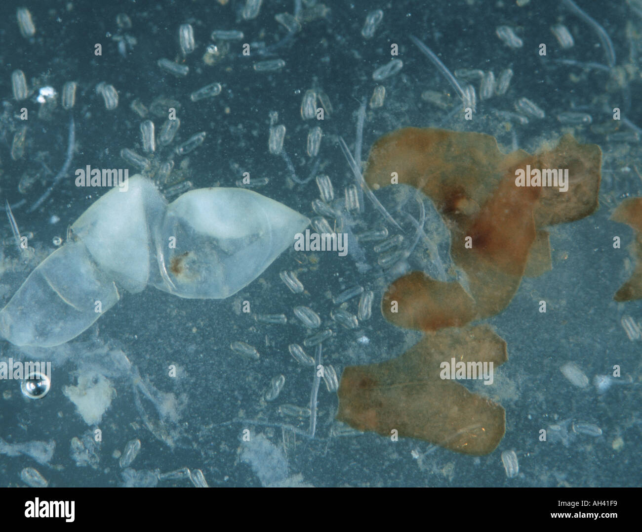 A cyst of golden potato cyst nematode Globodera rostochiensis split ...