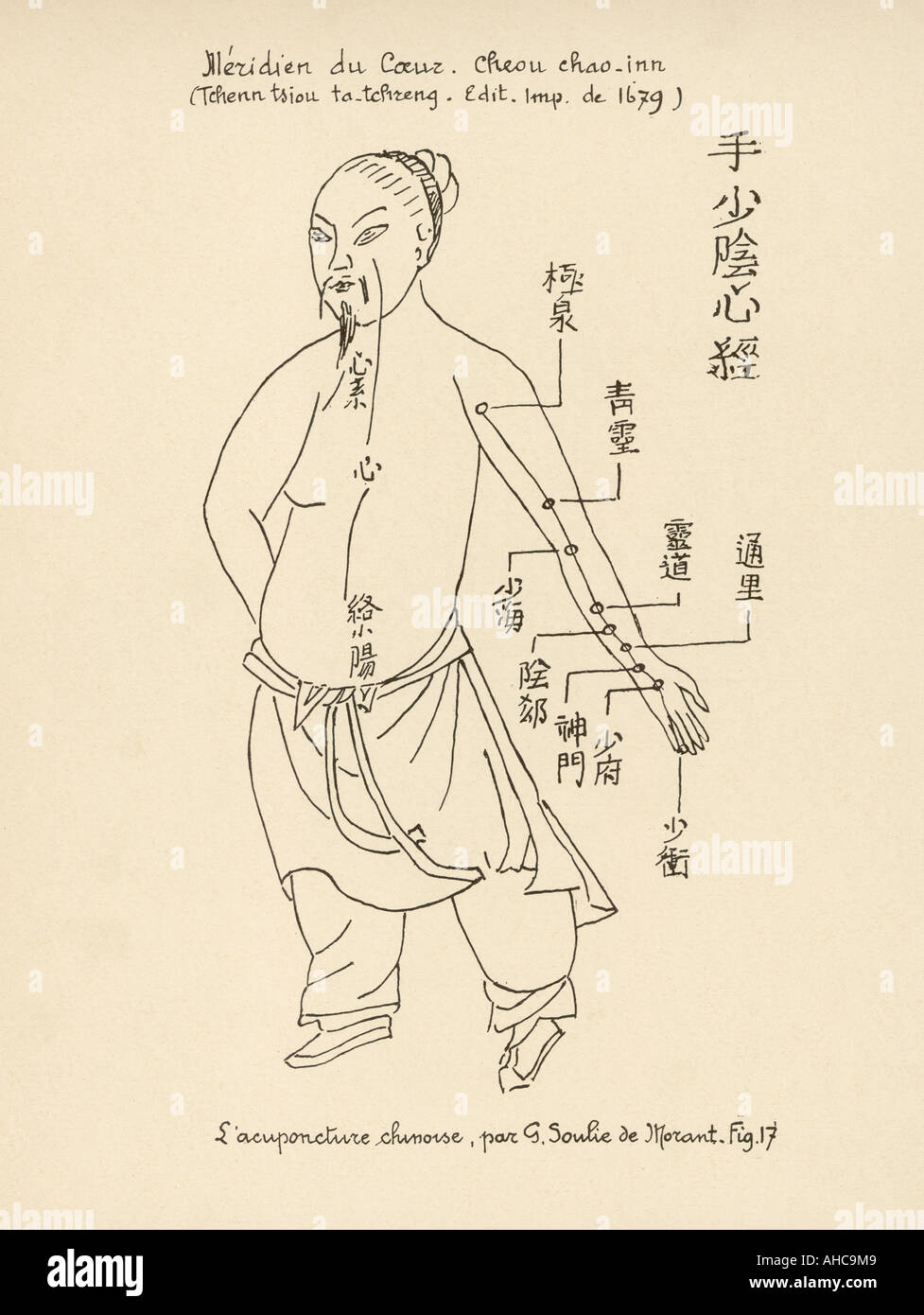 Acupuncture heart hi-res stock photography and images - Alamy