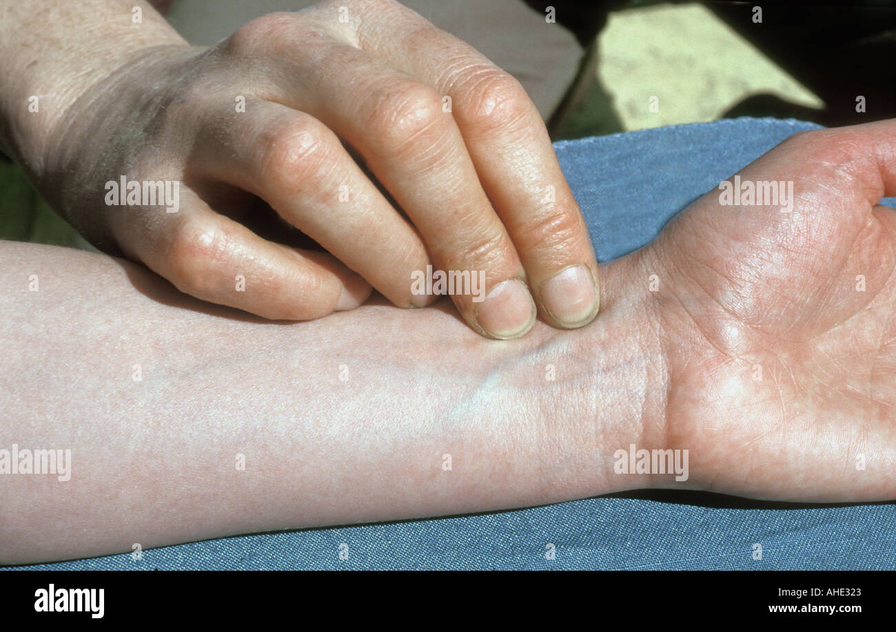 Nurse checking woman’s pulse Stock Photo - Alamy