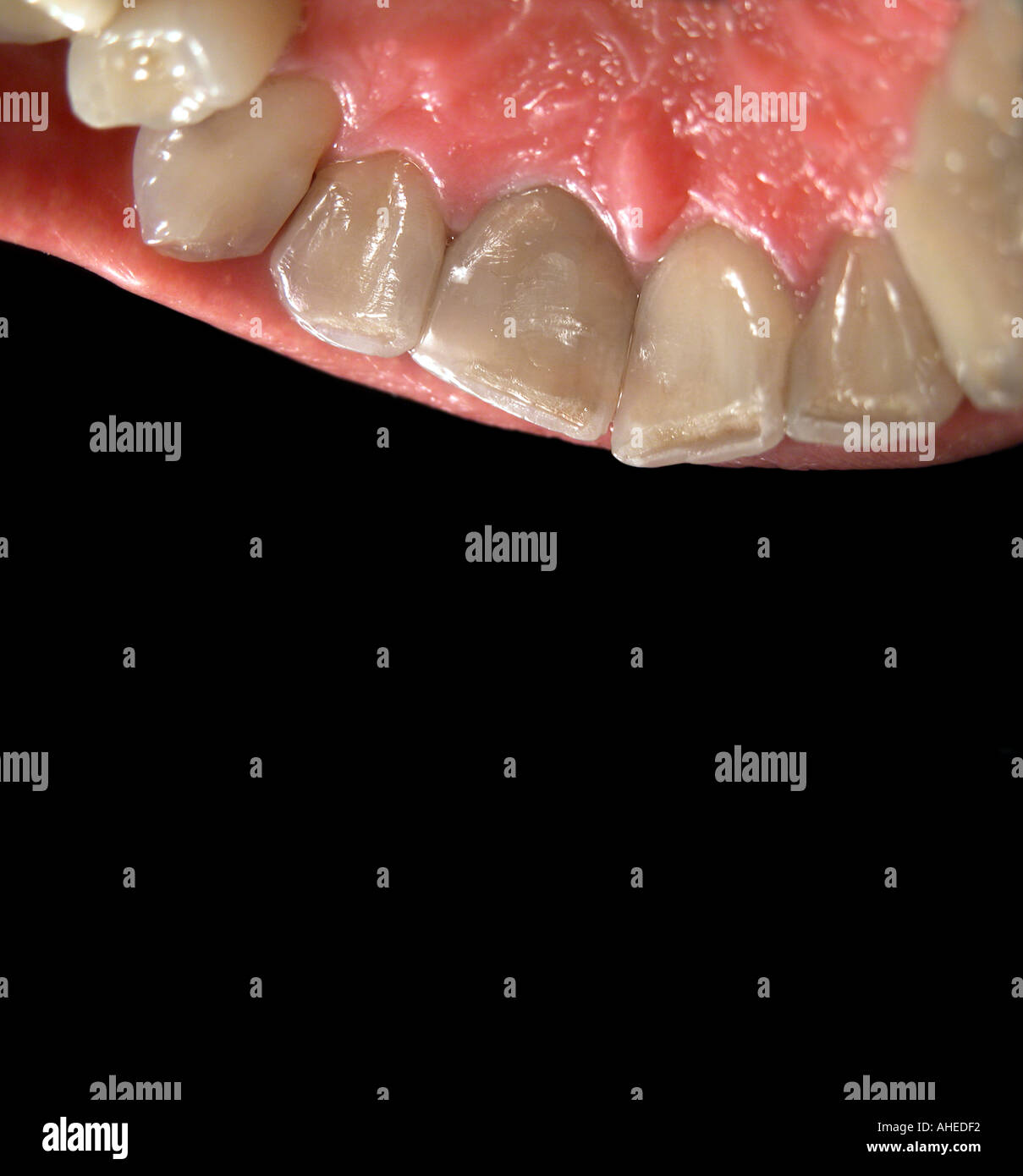 CLOSE UP OF rows of teeth tooth seen from inside the mouth dark black ...