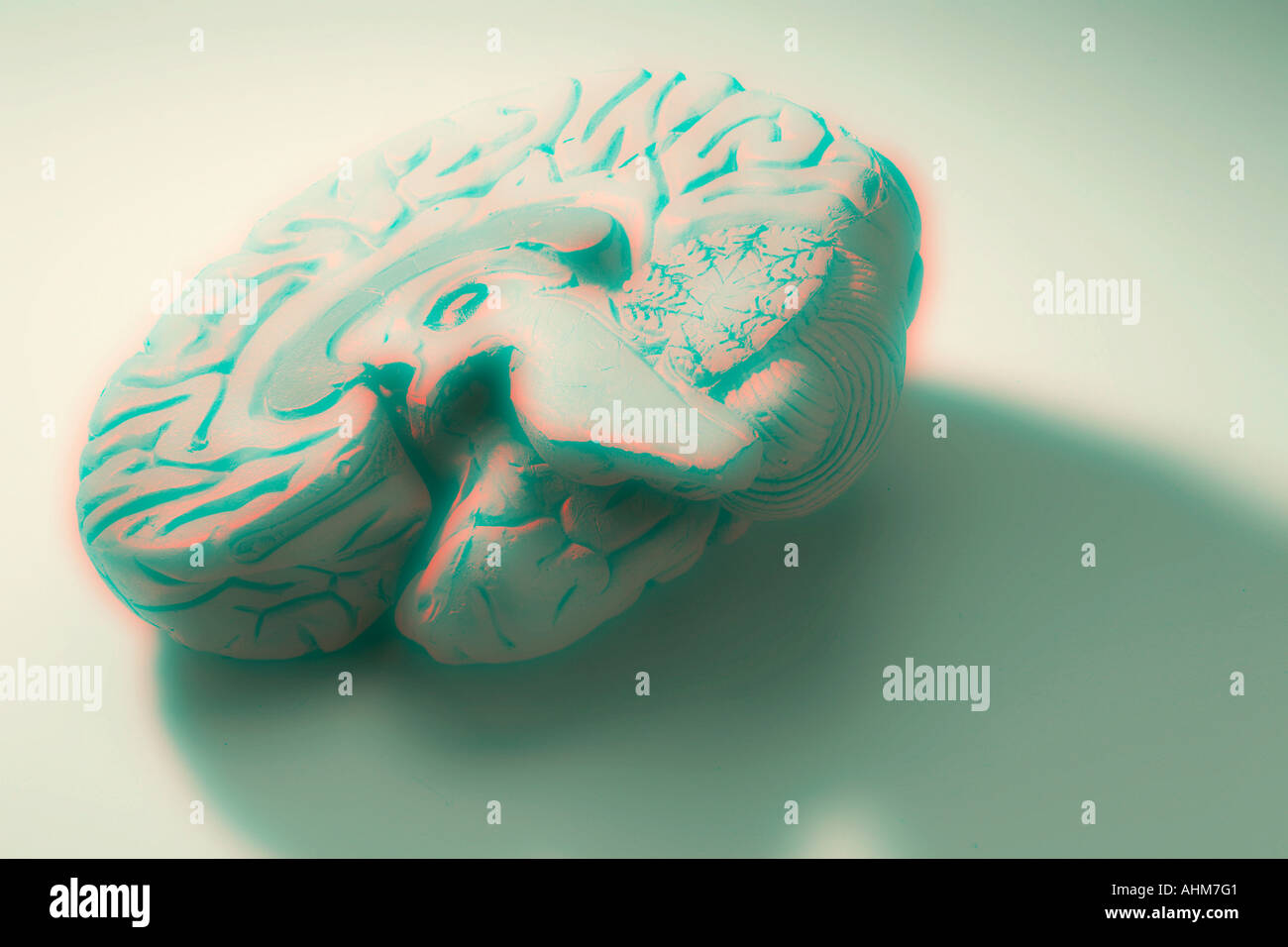 Anatomy Specimen of Human Brain Stock Photo - Alamy