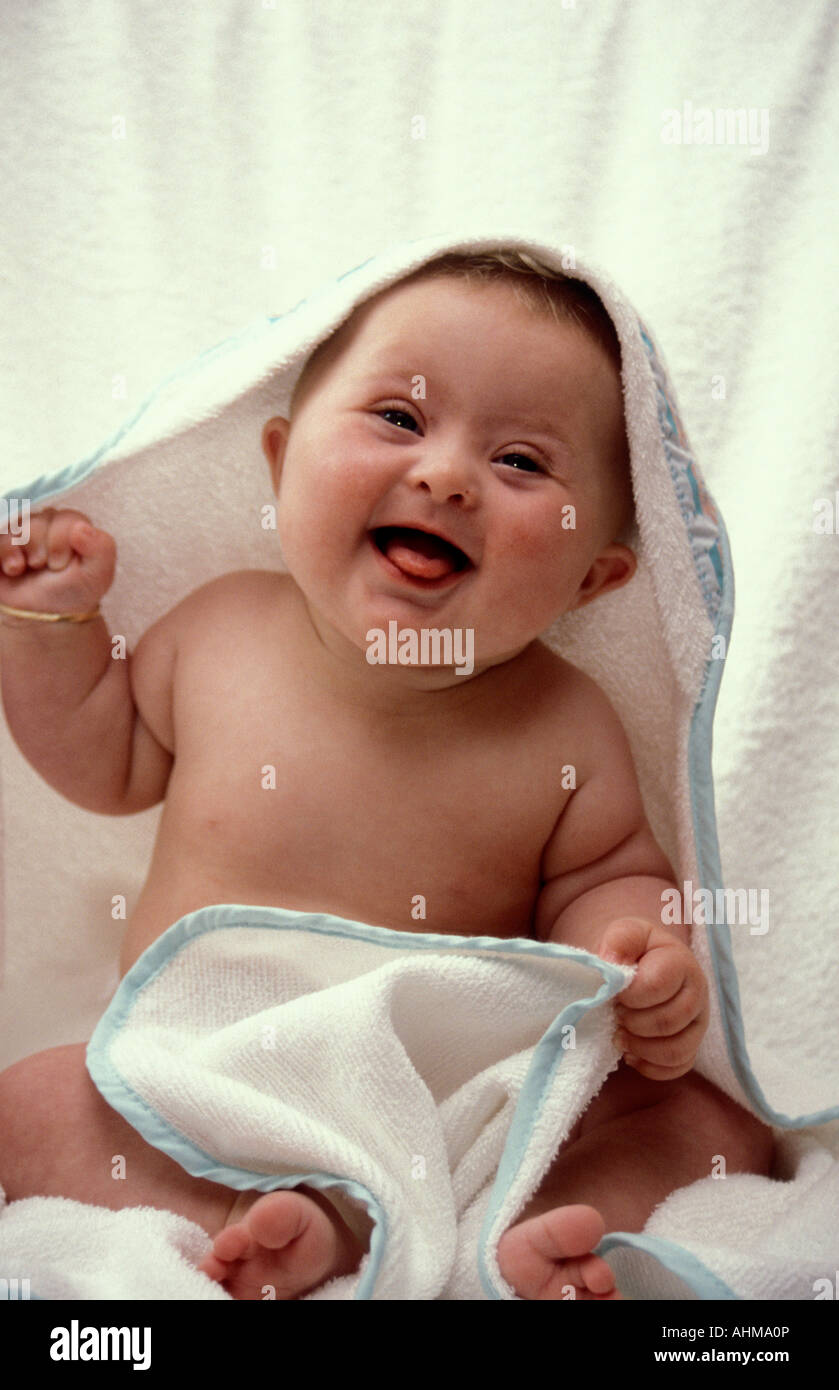 Down syndrome baby hi-res stock photography and images - Alamy