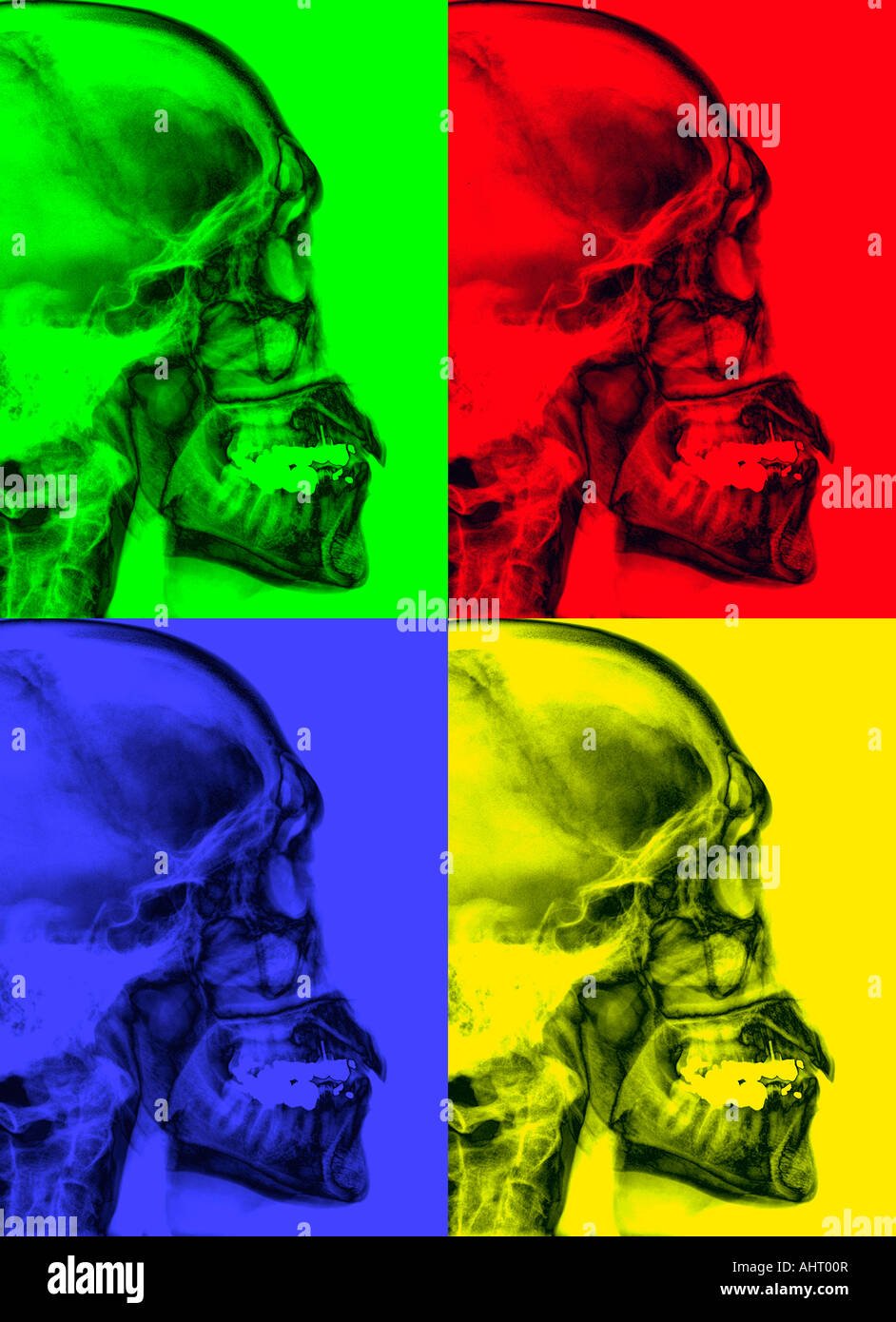 multi colored view of a digital x-ray of a human skull Stock Photo - Alamy