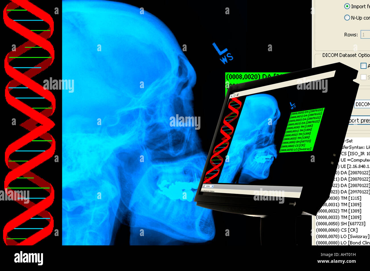 digital x-ray human skull computer monitor Stock Photo - Alamy