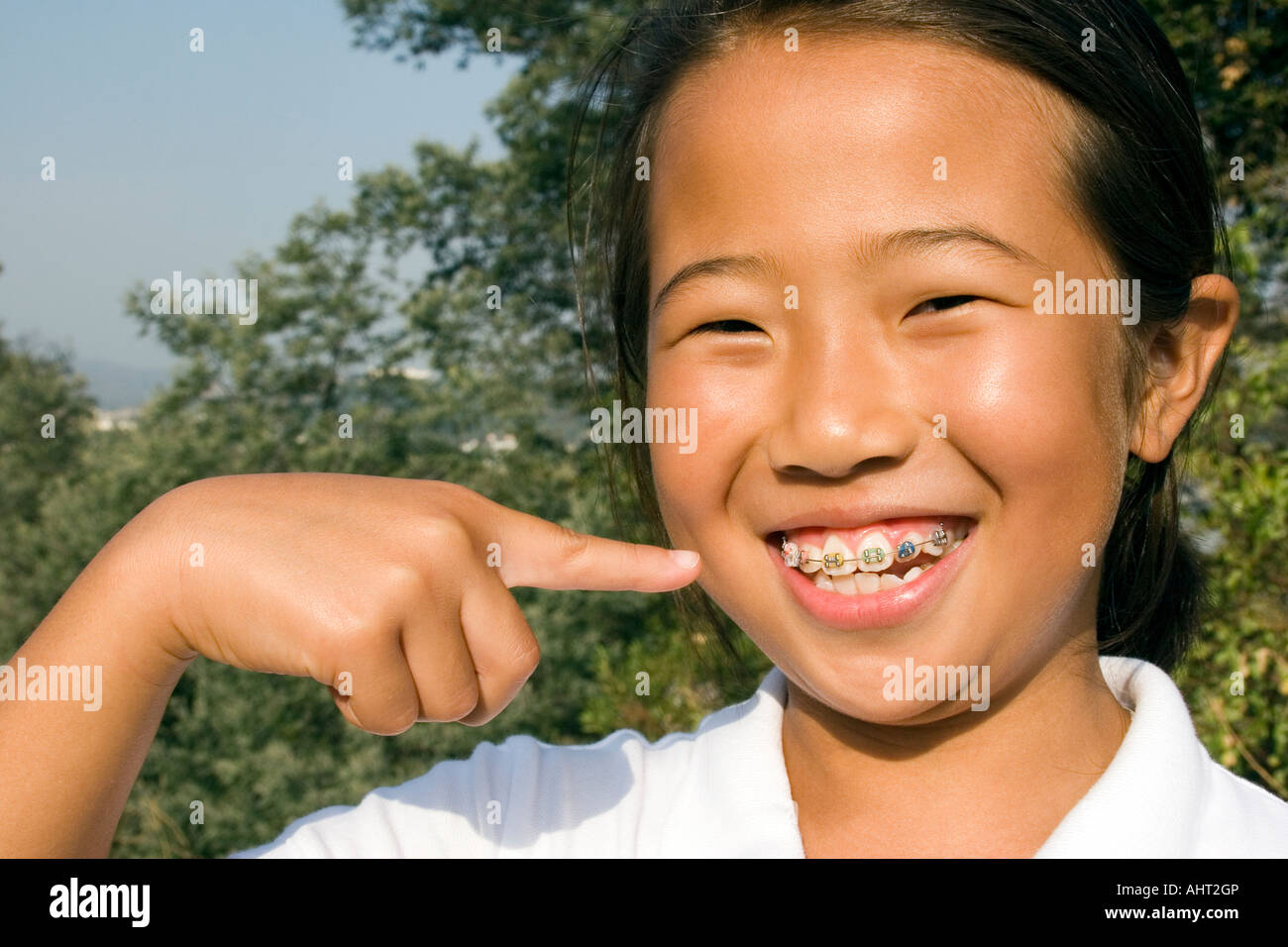 Young Girl Pointing to her Mouth with Braces Stock Photo - Alamy