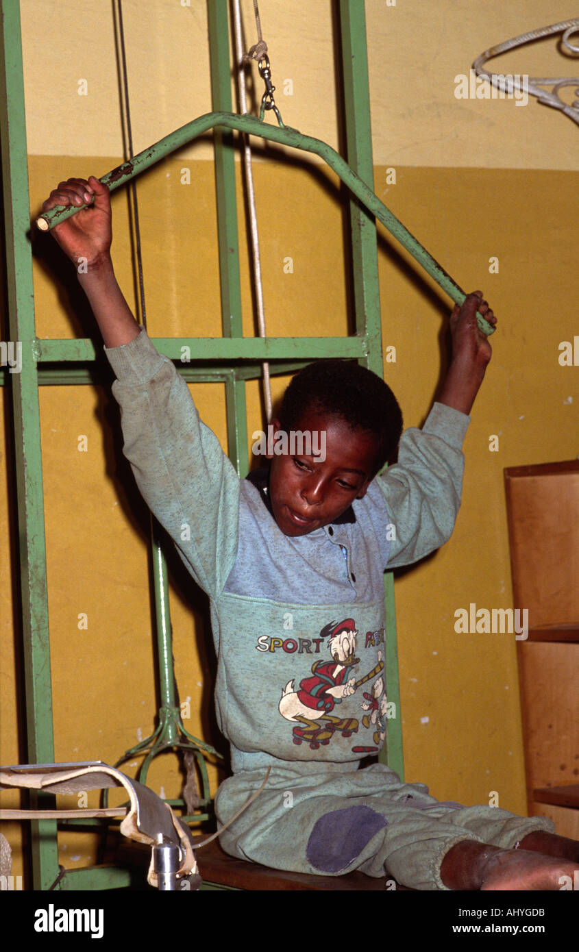 Young boy with polio using an exercise machine at a treatment centre in ...