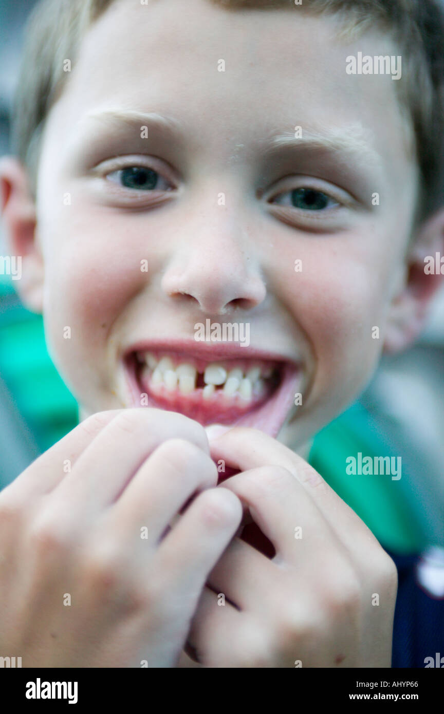 Show new teeth hi-res stock photography and images - Alamy