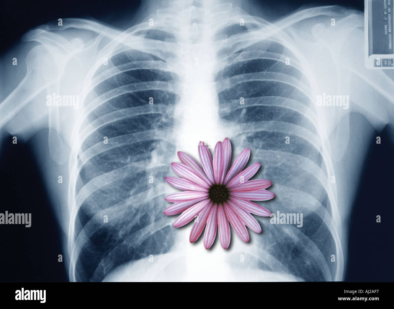 x ray with flower Stock Photo - Alamy