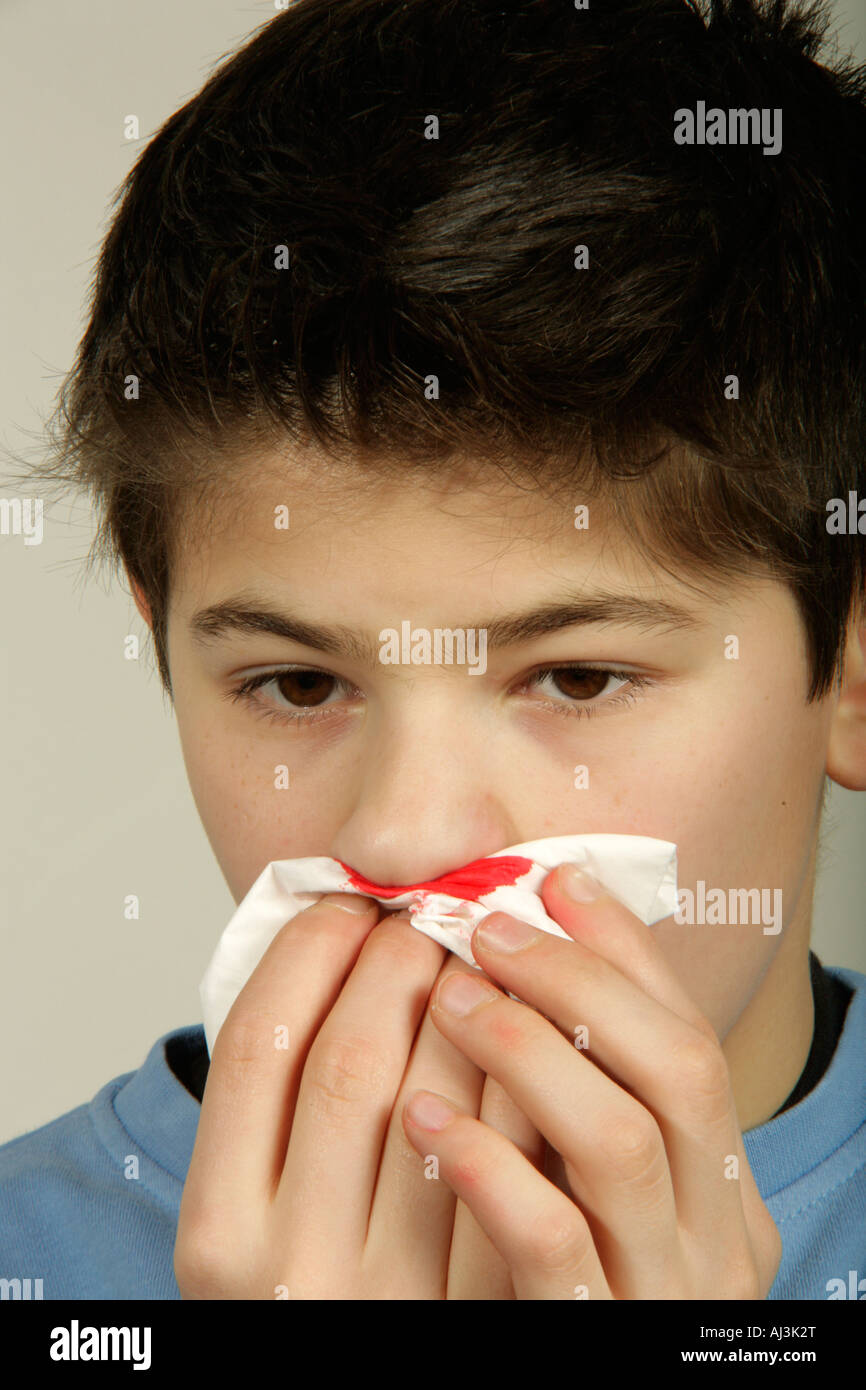 Boy bleeding nose hi-res stock photography and images - Alamy