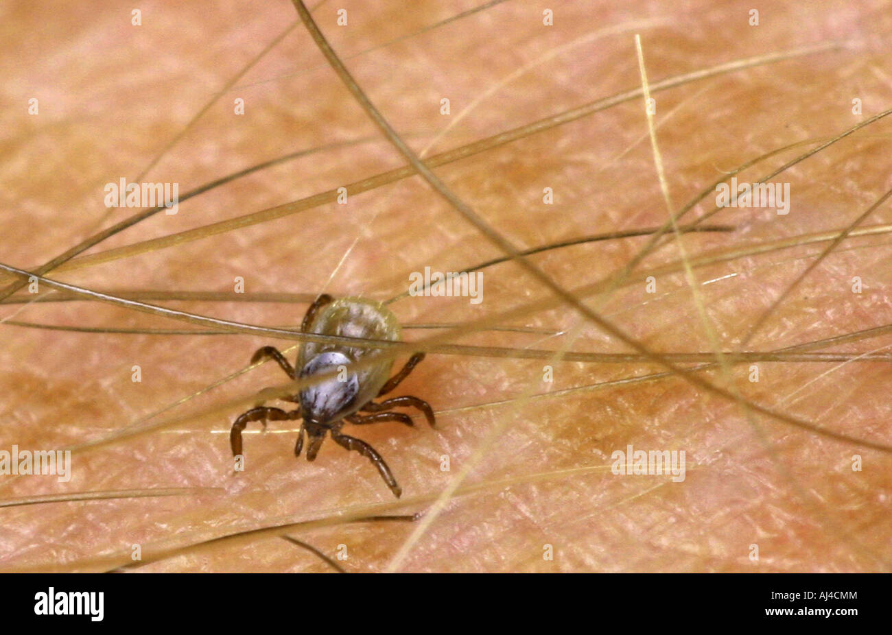 European castor bean tick European sheep tick Ixodes ricinus on human ...