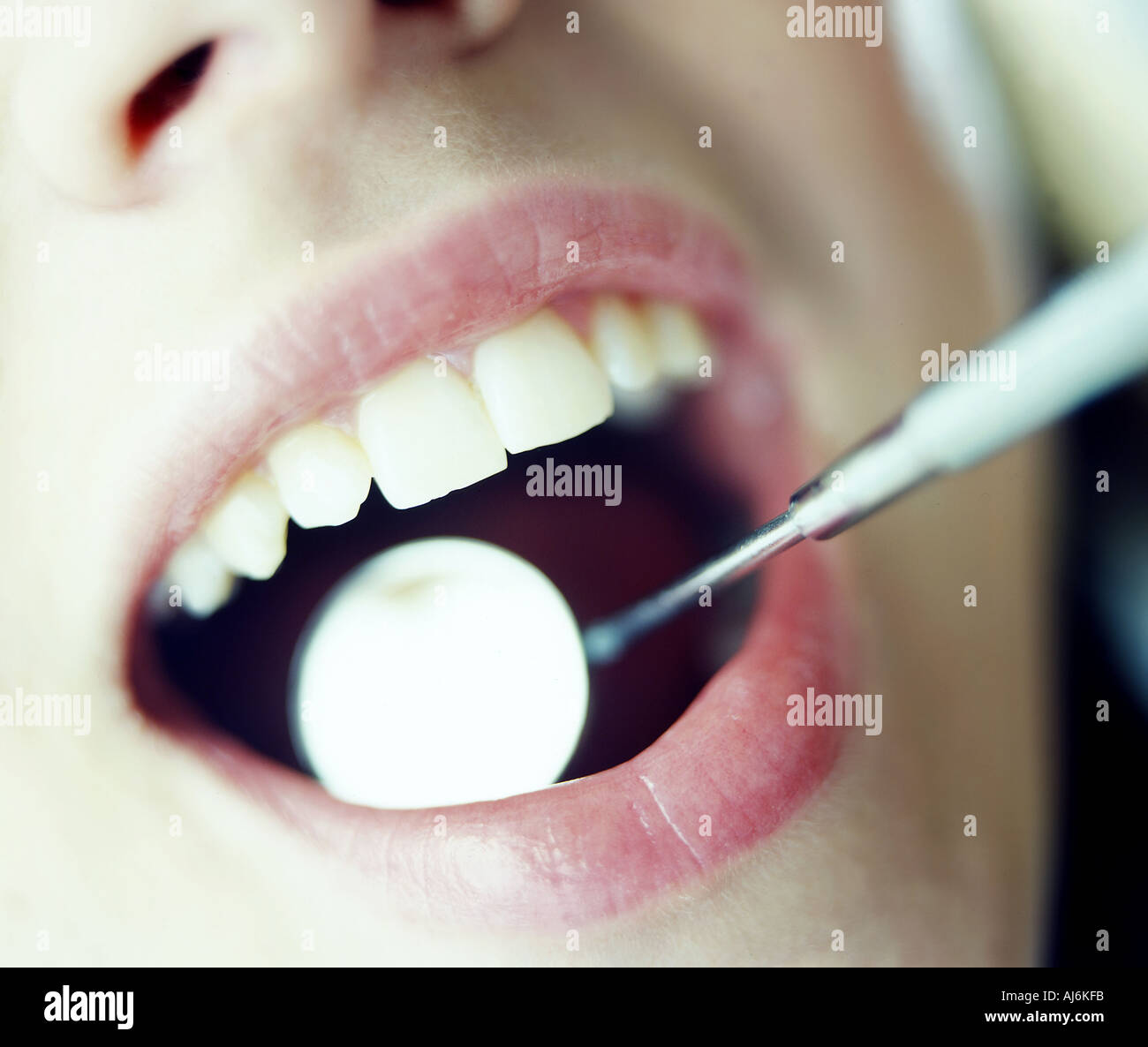 Woman's teeth examination Stock Photo - Alamy
