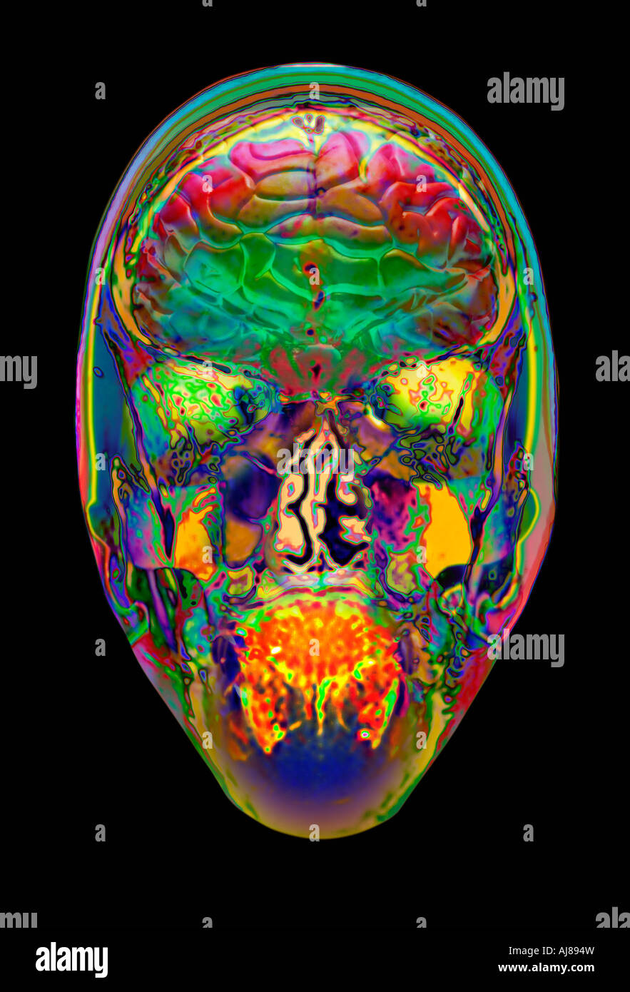 Mri brain scan hi-res stock photography and images - Alamy