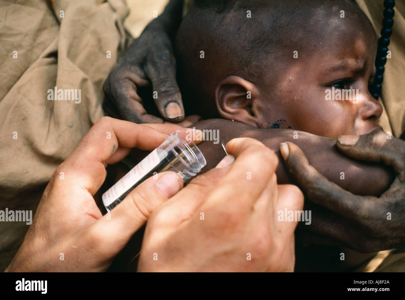 Smallpox hi-res stock photography and images - Alamy