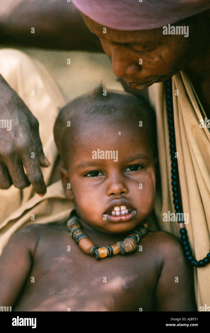 Smallpox hi-res stock photography and images - Alamy
