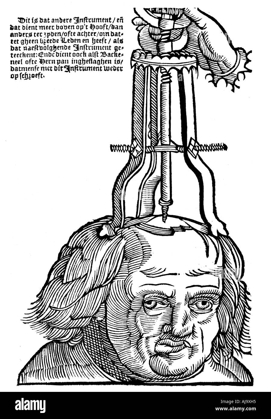 Trephination hi-res stock photography and images - Alamy