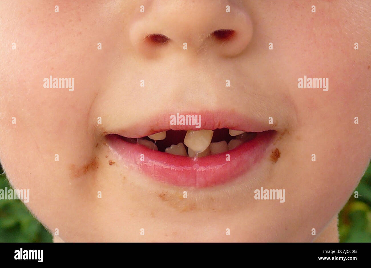 Wobbly teeth hi-res stock photography and images - Alamy