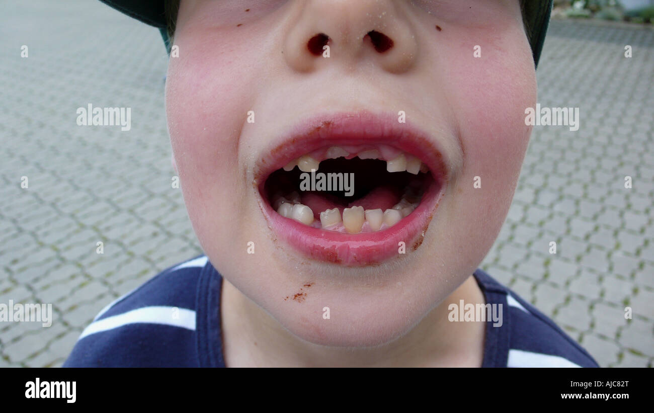 little boy with tooth gap Stock Photo - Alamy