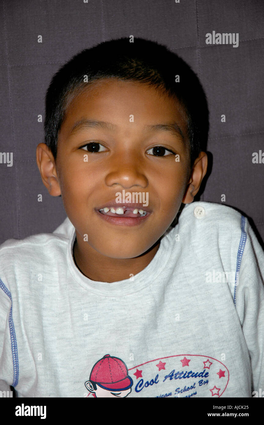 boy wisdom tooth Stock Photo - Alamy