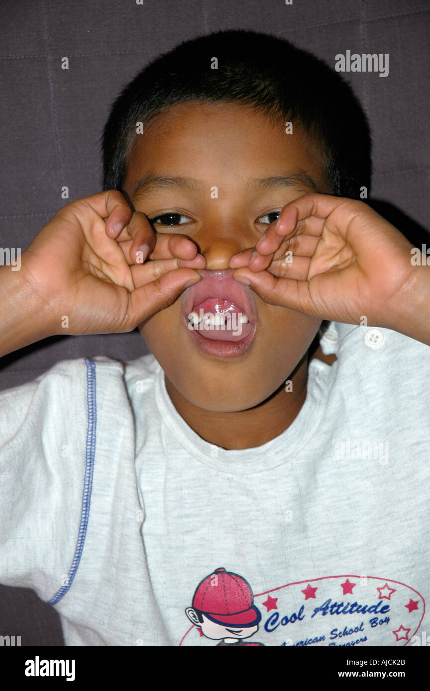 boy wisdom tooth Stock Photo - Alamy